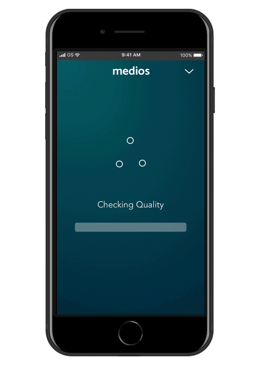 Fundus Camera for Portable Retinal Imaging – Remidio Vision Hub - Your ...