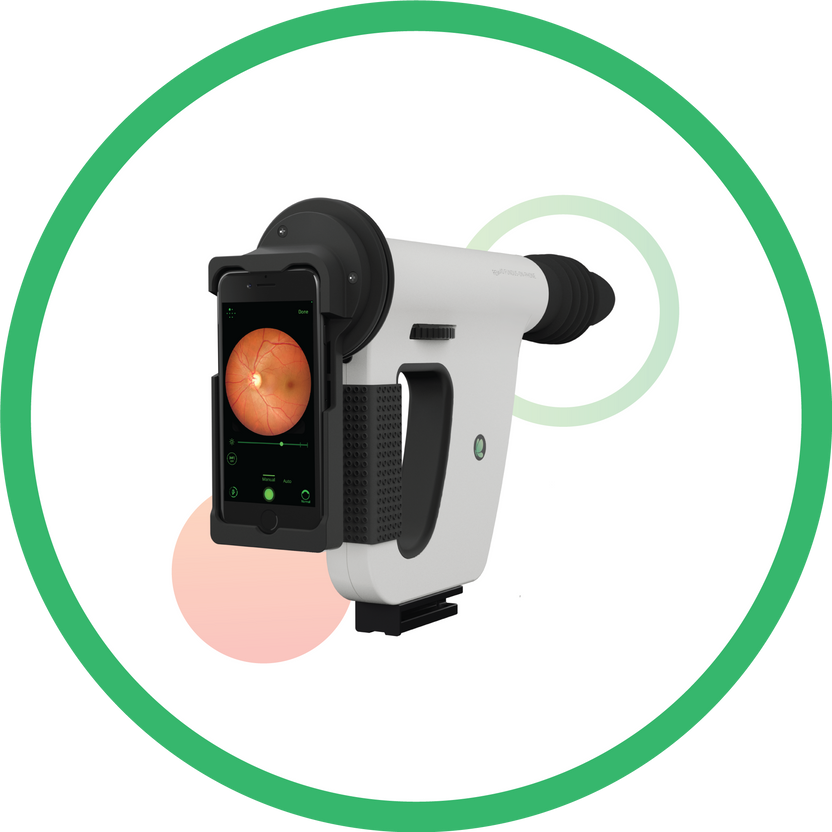 Fundus Camera for Portable Retinal Imaging